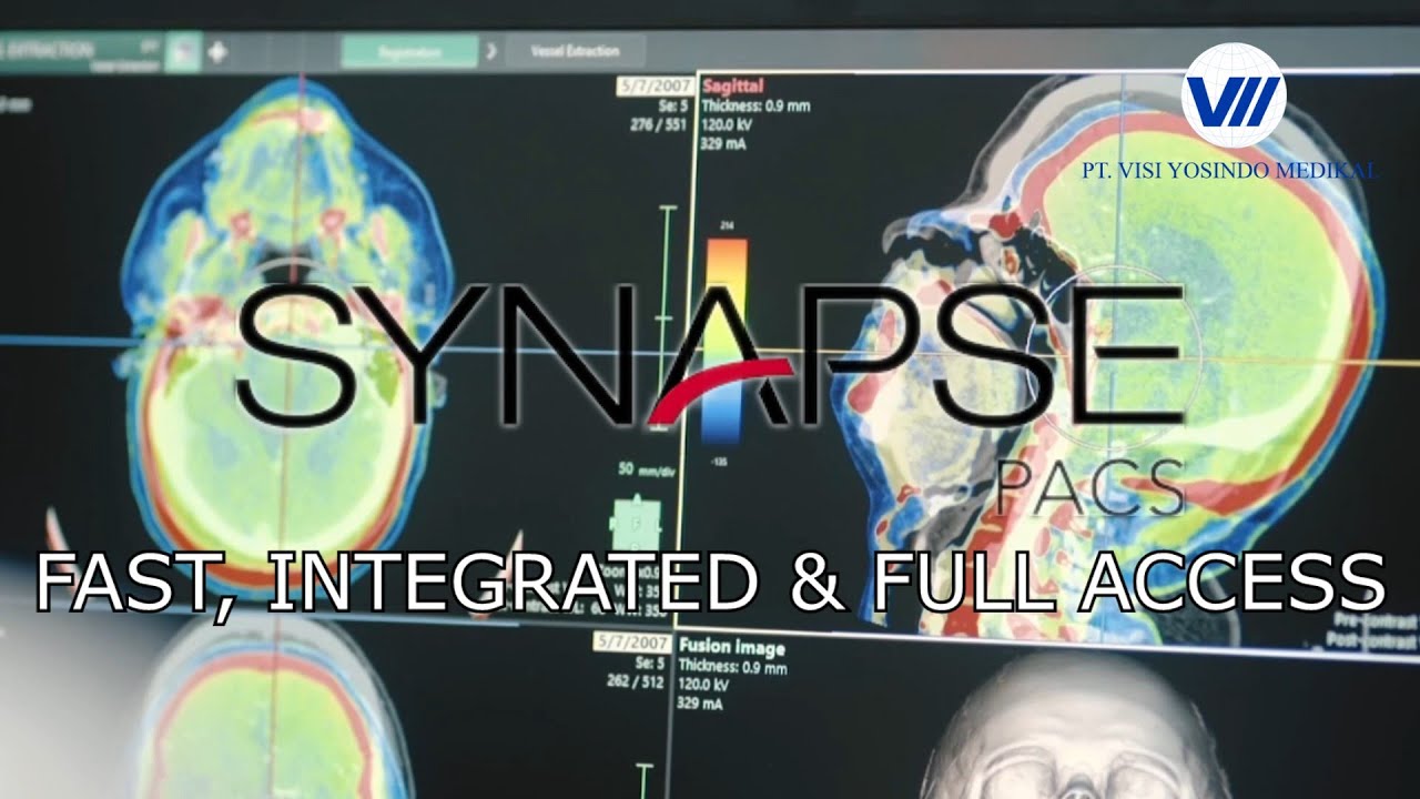 FUJIFILM SYNAPSE PACS - PENCITRAAN MEDIS YANG CEPAT, TERINTEGRASI DAN FULL ACCESS - YouTube