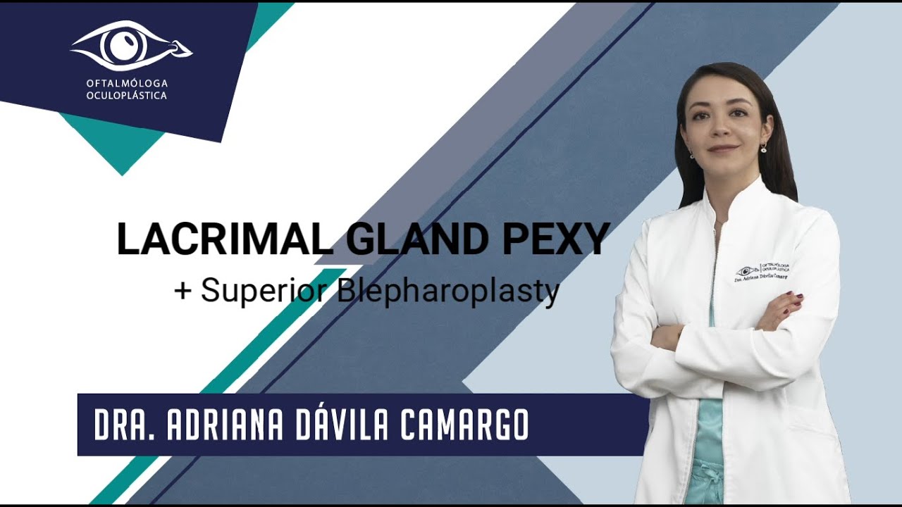 LACRIMAL GLAND PEXY - YouTube