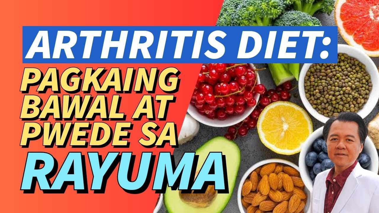 Arthritis Diet: Pagkaing Bawal at Pwede sa Rayuma - Payo ni Doc Liza ...