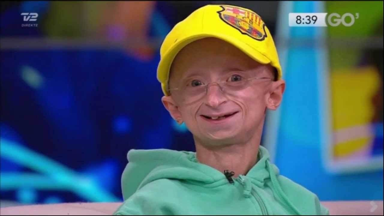 27/12: TV2 Go' Morgen Danmark med Jesper Sørensen - Progeria - Lalandia ...