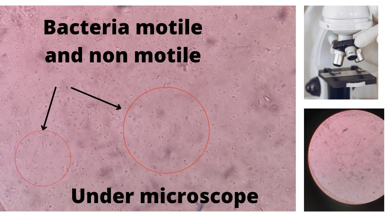 Bacteria under microscope | Motile and non motile bacteria ...