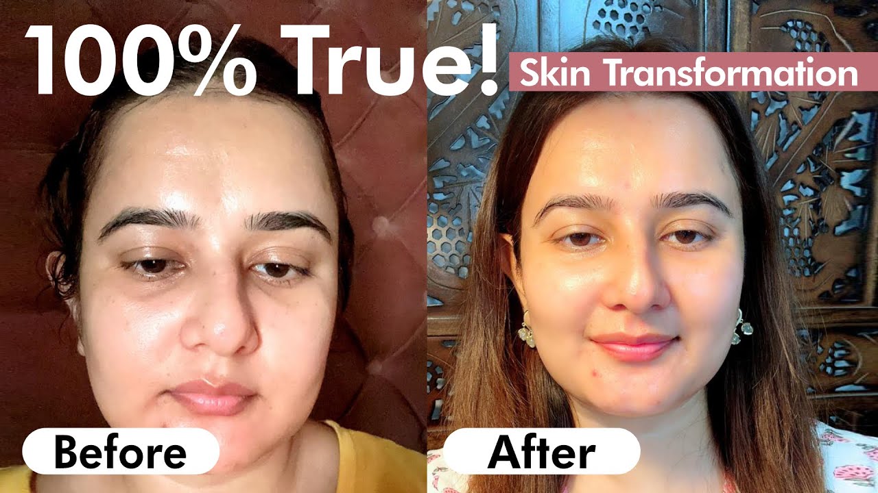 SKin Care: स्किन होगी ब्राइट और टाइट।How I change my skin tone| skin ...
