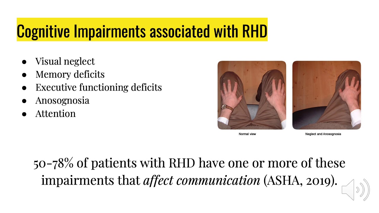 COSD 619: Right Hemisphere Disorder - YouTube