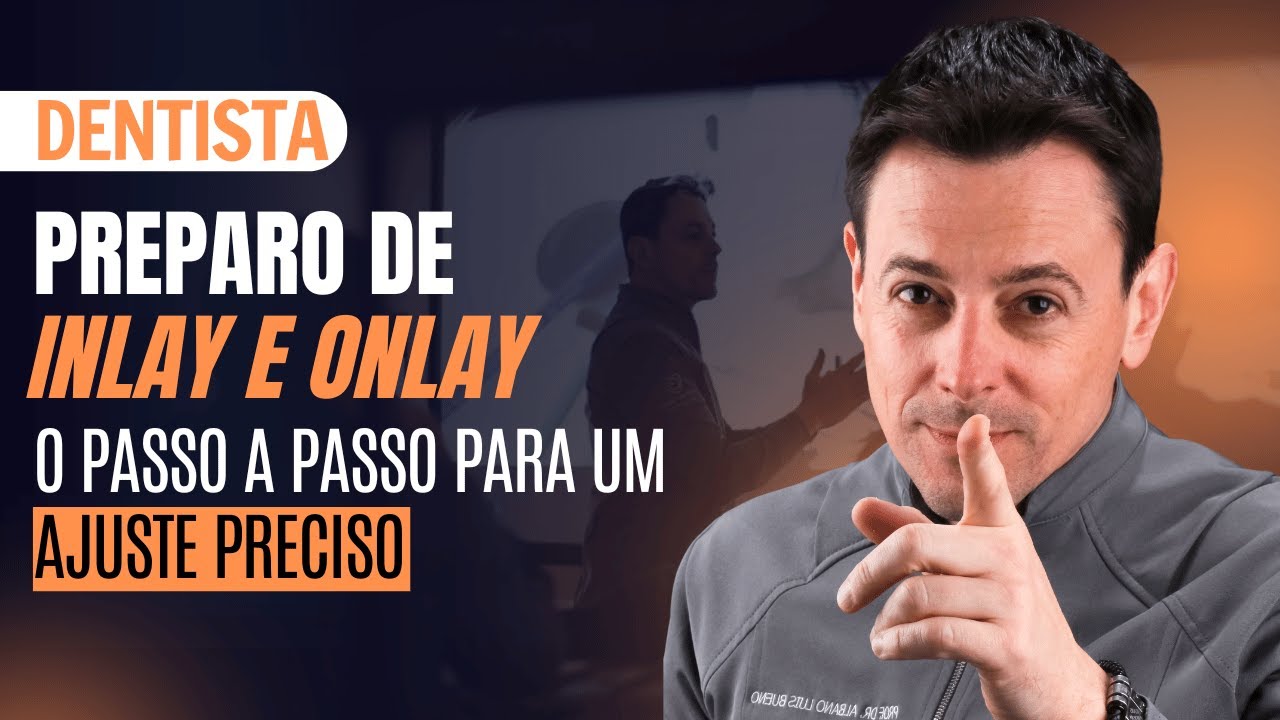 Inlays e Onlays. O Que Preciso Saber Para Preparar Os Dentes - YouTube