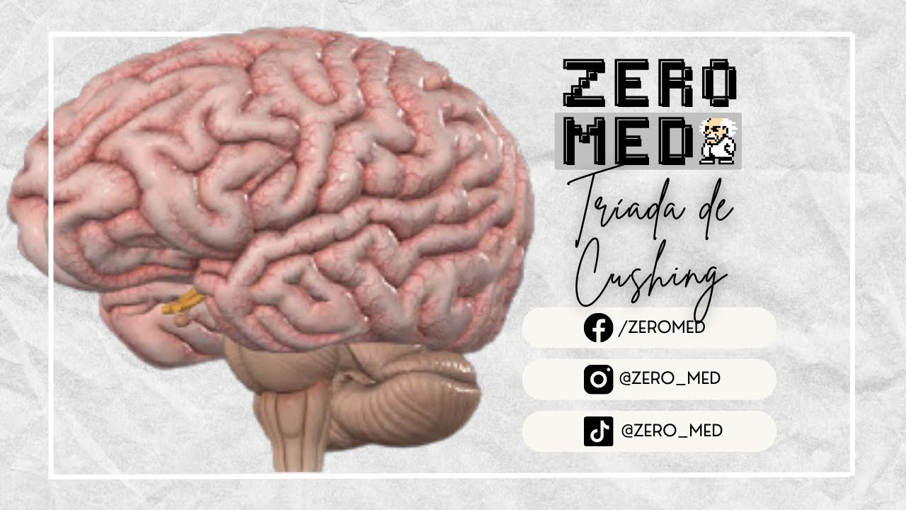 Tríada de Cushing | Neurología - YouTube