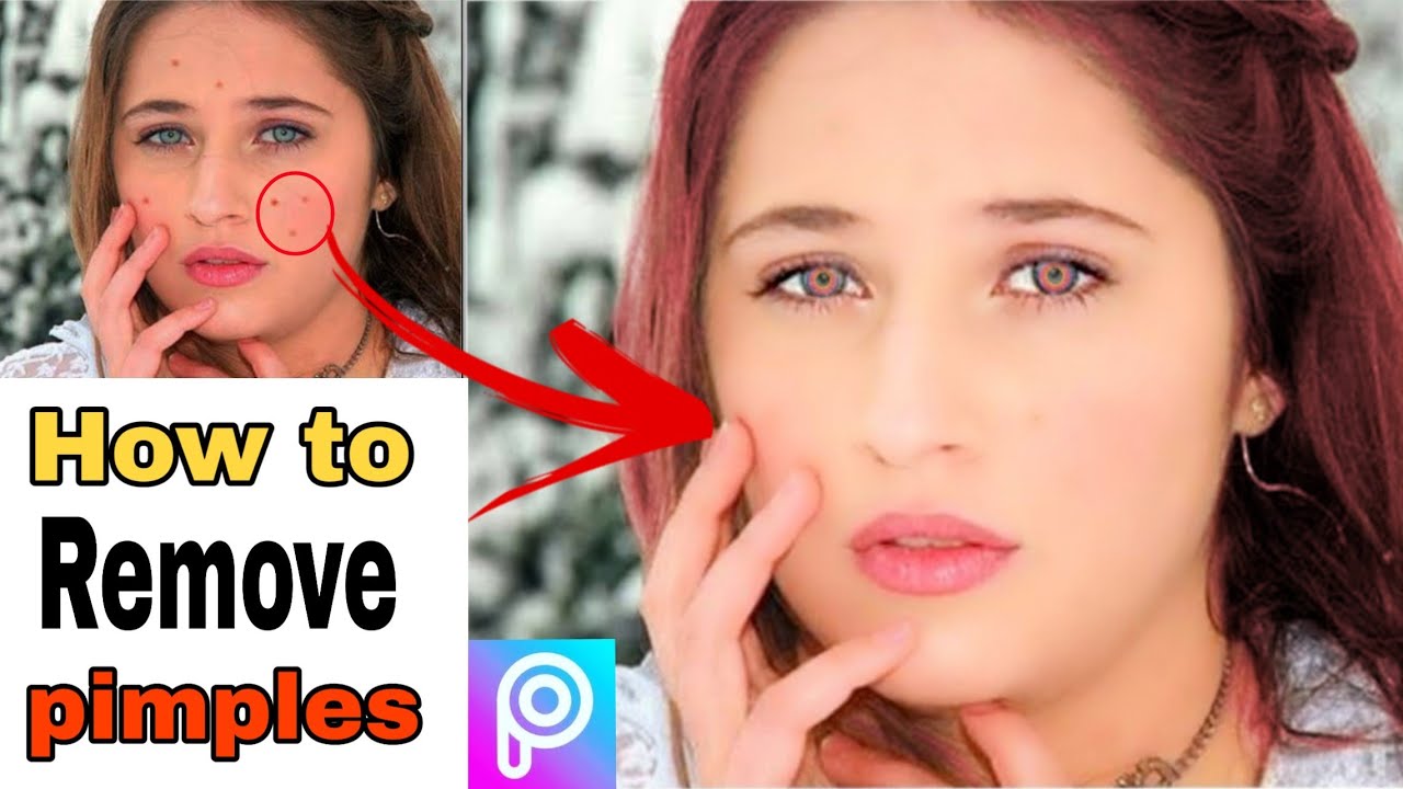 How to clean face and remove pimple || 🔥 clean face and smoothness ...