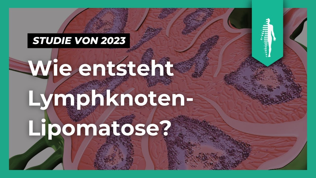 Lymphknoten-Lipomatose: Aktuelle Studie untersucht Veränderungen im ...