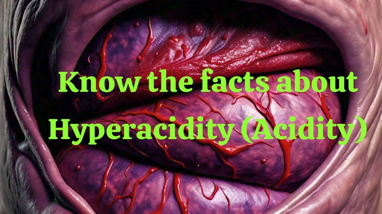 Acidity:Hyperacidity and its cure , By Doctor Riya - YouTube