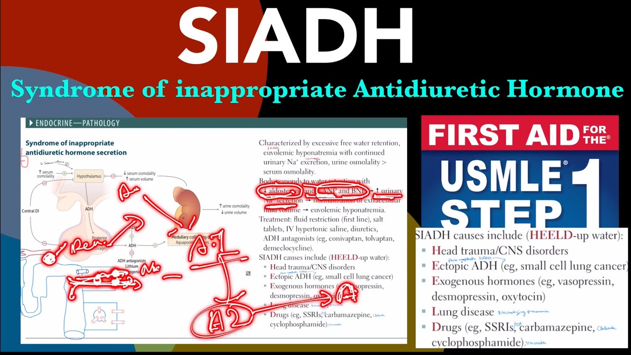 SIADH- Syndrome of inappropriate ADH syndrome in Hindi/Urdu by first ...