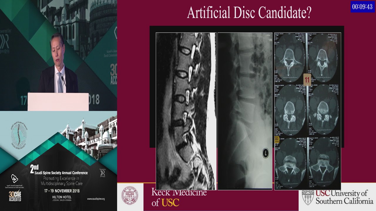 Dynamic MRI for Spine Surgrey Planning by Prof. Jeffrey Wang - YouTube