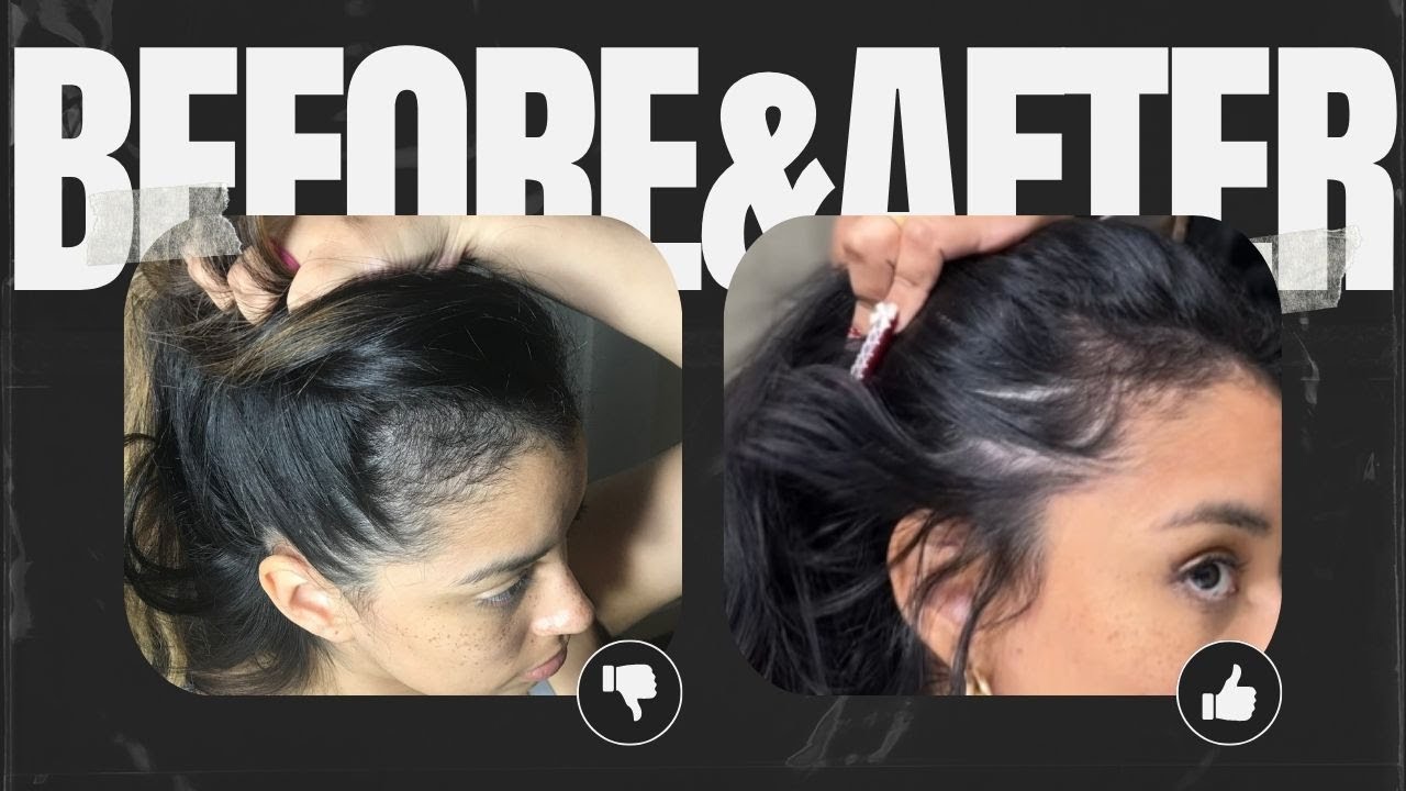 DO THIS on your hair growth JOURNEY #hairlosstips - YouTube