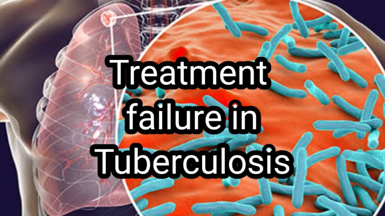 Treatment failure in Tuberculosis. Why TB treatment fails. Colours of ...