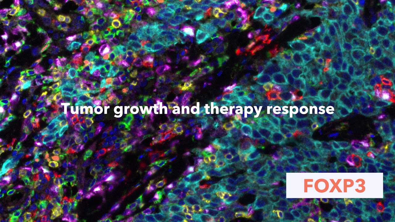 PerkinElmer: Vectra Polaris Automated Quantitative Pathology Imaging ...