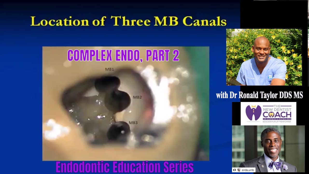 Root Canal Treatment Steps | Complex Anatomy, Part 2 | GPR Lecture ...