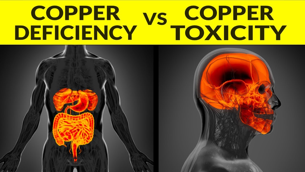 Copper Deficiency Or Toxicity Should You Supplement Or Detox Copper