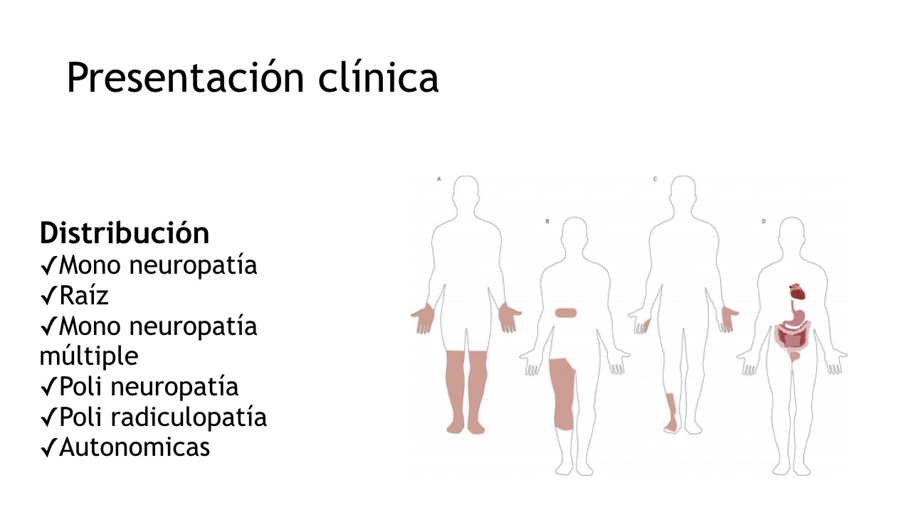 Neuropatia 1 Intro y abordaje inicial video - YouTube
