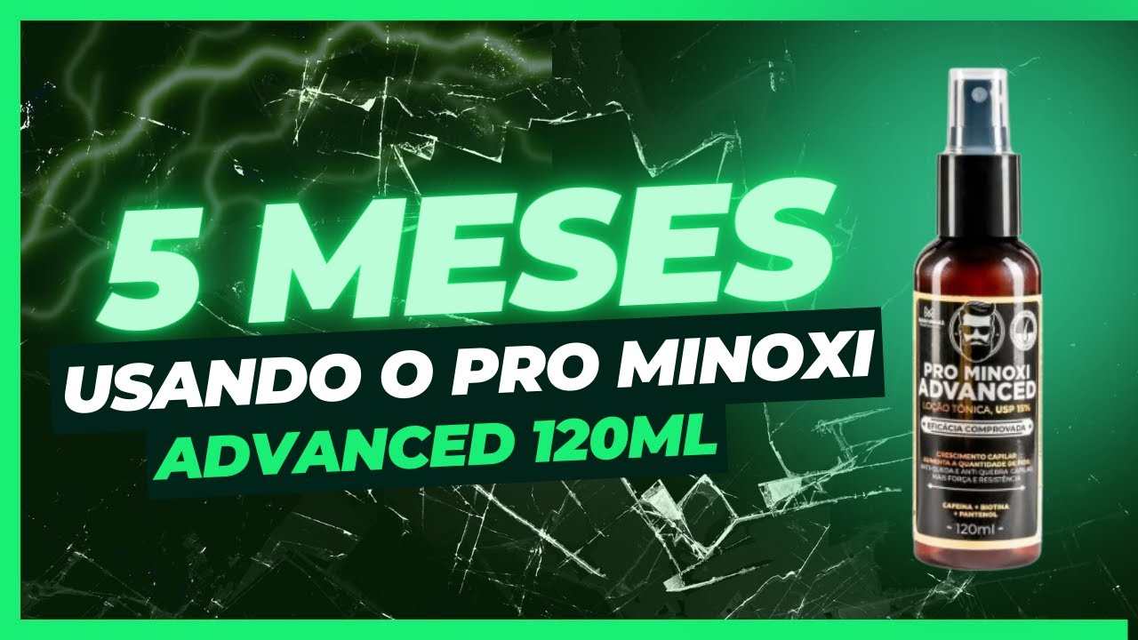 TESTEI por 5 meses o Pro Minoxi Advanced Cresce Barba e Cabelo - YouTube