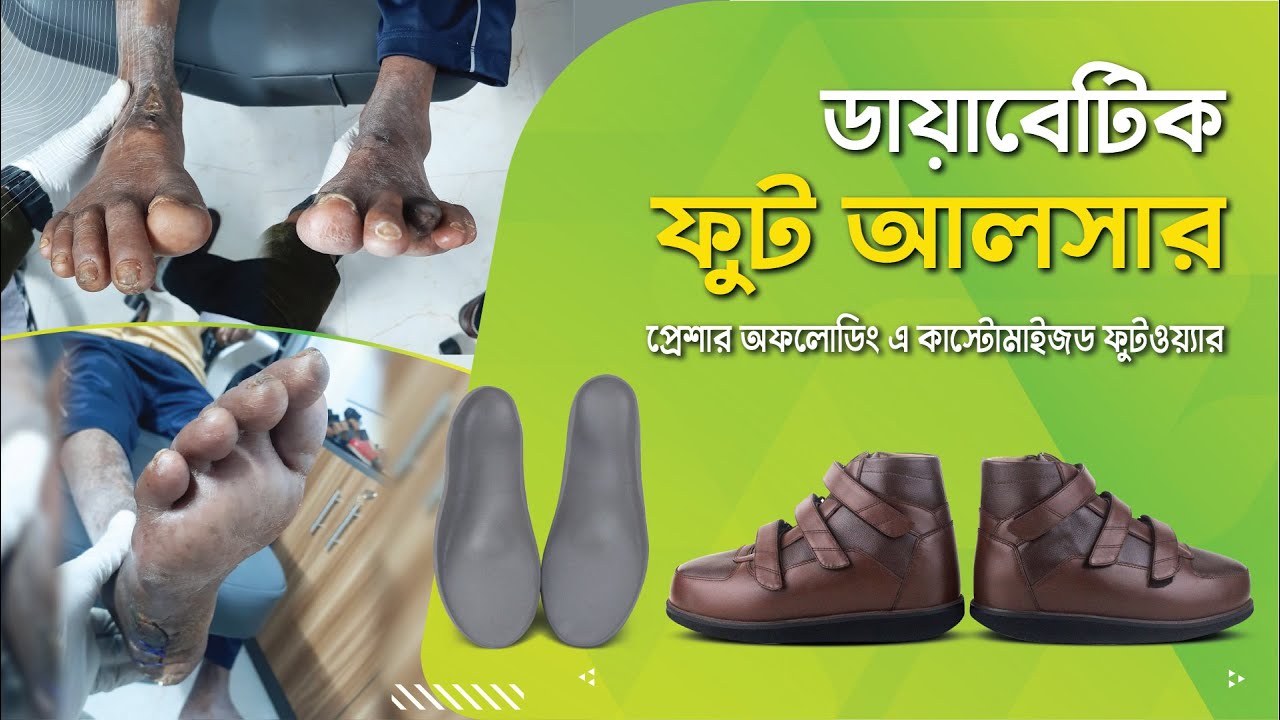 Restoring Mobility with Customized Footwear and Pressure Offloading for ...