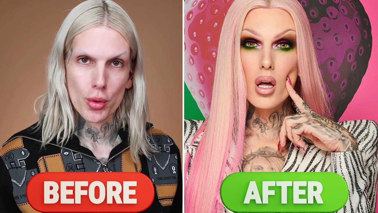 CELEBRITY BEFORE AND AFTER PLASTIC SUERGERY | JEFFREE STAR - YouTube