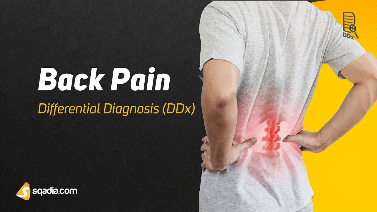 Back Pain Differential Diagnosis | DDx - YouTube