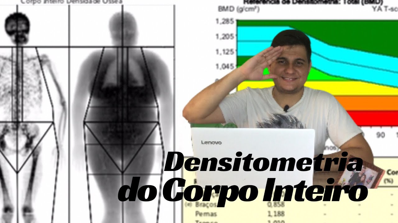 Composição Corporal na Densitometria Óssea | Radiologia Prática - YouTube