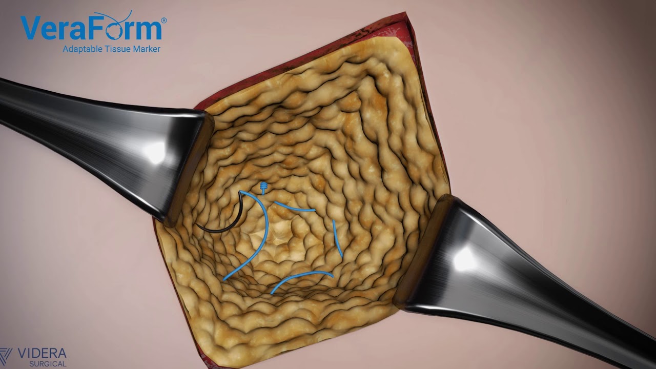 VeraForm quick overview - YouTube