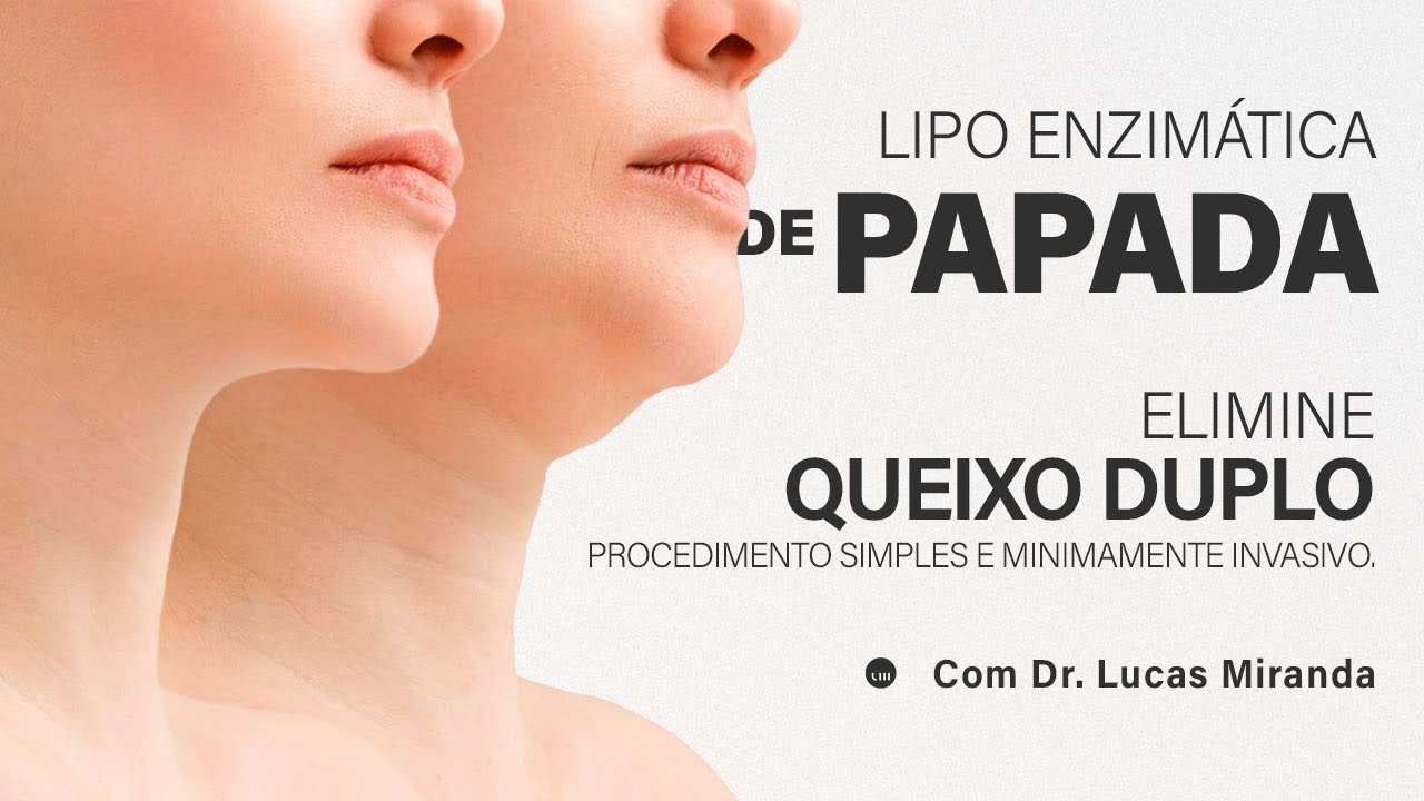 Lipo de papada: acabe com a papada de forma rápida e eficaz - YouTube