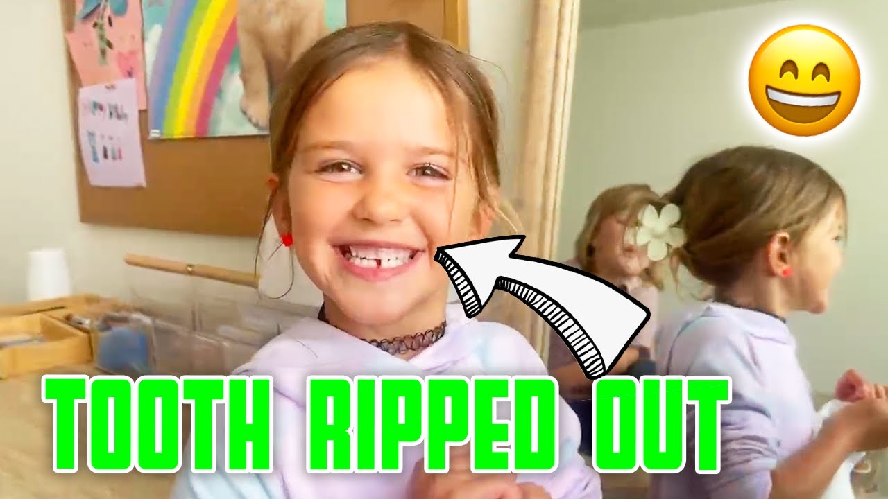 SIX YEAR OLD PULLS TOOTH OUT WITH HER FRIENDS | PULLING A TOOTH OUT ...