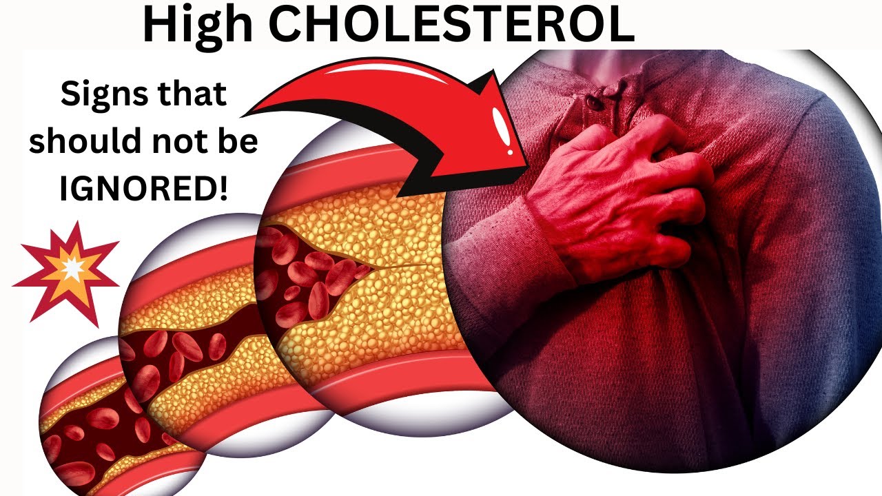5 Warning Signs of High CHOLESTEROL - YouTube