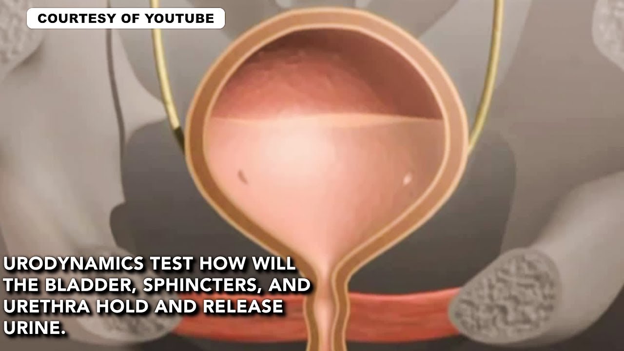 Facts about urodynamics | Usapang Pangkalusugan - YouTube