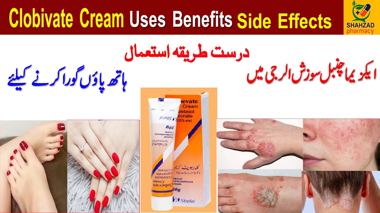 Clobevate Cream For Whitening | Clobivate Cream For Hands Whiteing ...