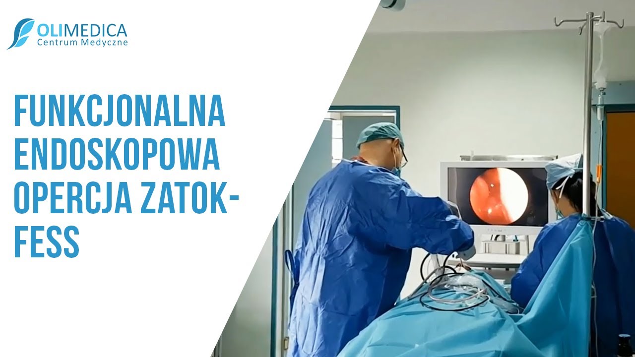 Jak wygląda Funkcjonalna Endoskopowa Operacja Zatok - FESS - YouTube