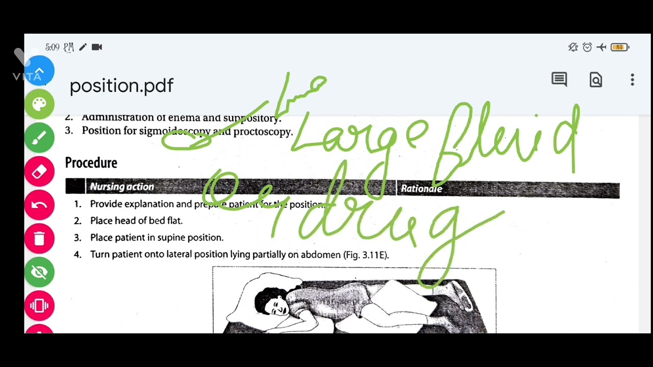 Position part-3 //Lateral lying //Sim's//Lithotomy//Trendelenburg ...
