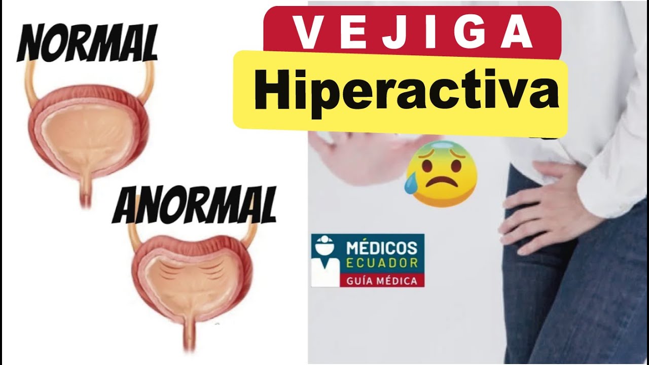 Vejiga Hiperactiva en Mujeres - YouTube