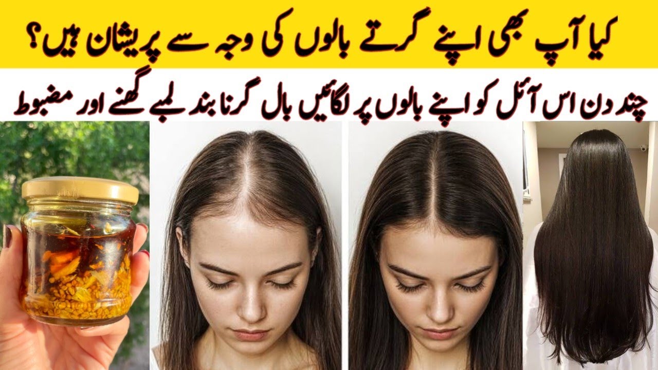 Hair Oil Remedy For Hair Growth | Hair Fall Solution | Hair Oil For ...