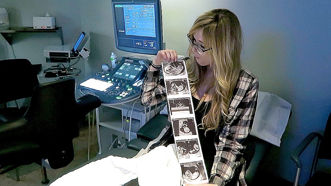 NUCHAL TRANSLUCENCY ULTRASOUND TEST AT 12 WEEKS! - YouTube