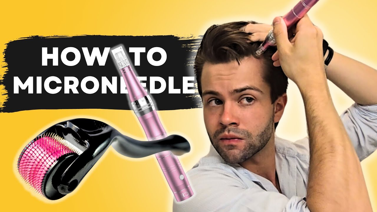 Derma Roller vs. Derma Pen: Which is Best for Hair Loss? - YouTube