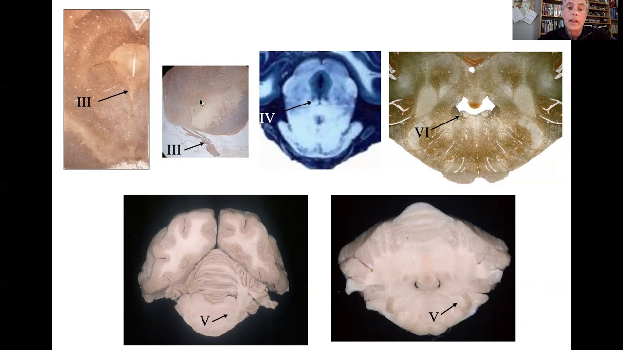 Cranial nerves. Part 1: Neuroanatomy of the dog - Lesson 15 - YouTube