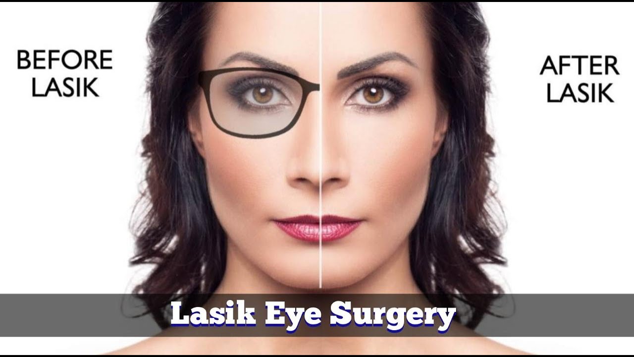 What is LASIK Eye Surgery? | How LASIK Eye Surgery Works | Explained ...