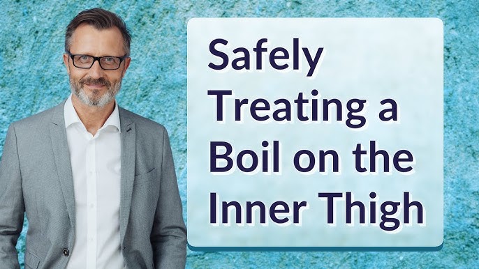 Boils On Inner Thigh Women