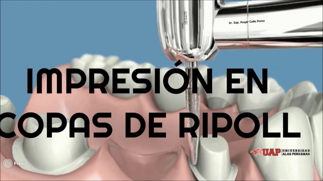 DR. ESP. ROGER CALLA - Impresion con Copas de Ripoll - YouTube