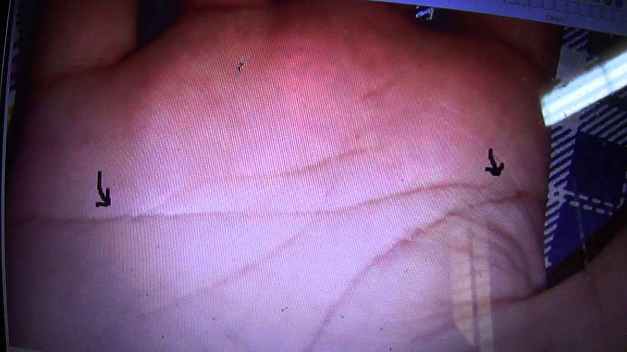 sample palm/simian line palmistry - YouTube