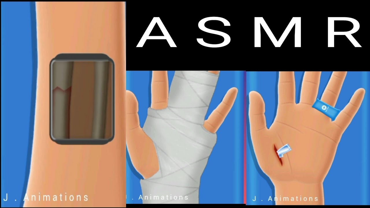 ASMR treatment animation/j . animations/ - YouTube