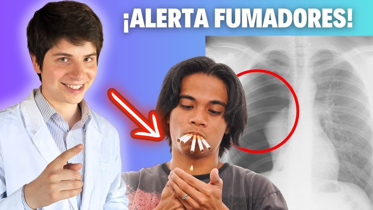 NEUMOTÓRAX a TENSIÓN FISIOPATOLOGÍA, SÍNTOMAS y CLASIFICACIÓN en 8 ...