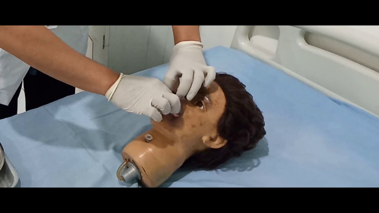 Simulasi Pemasangan OPA - YouTube