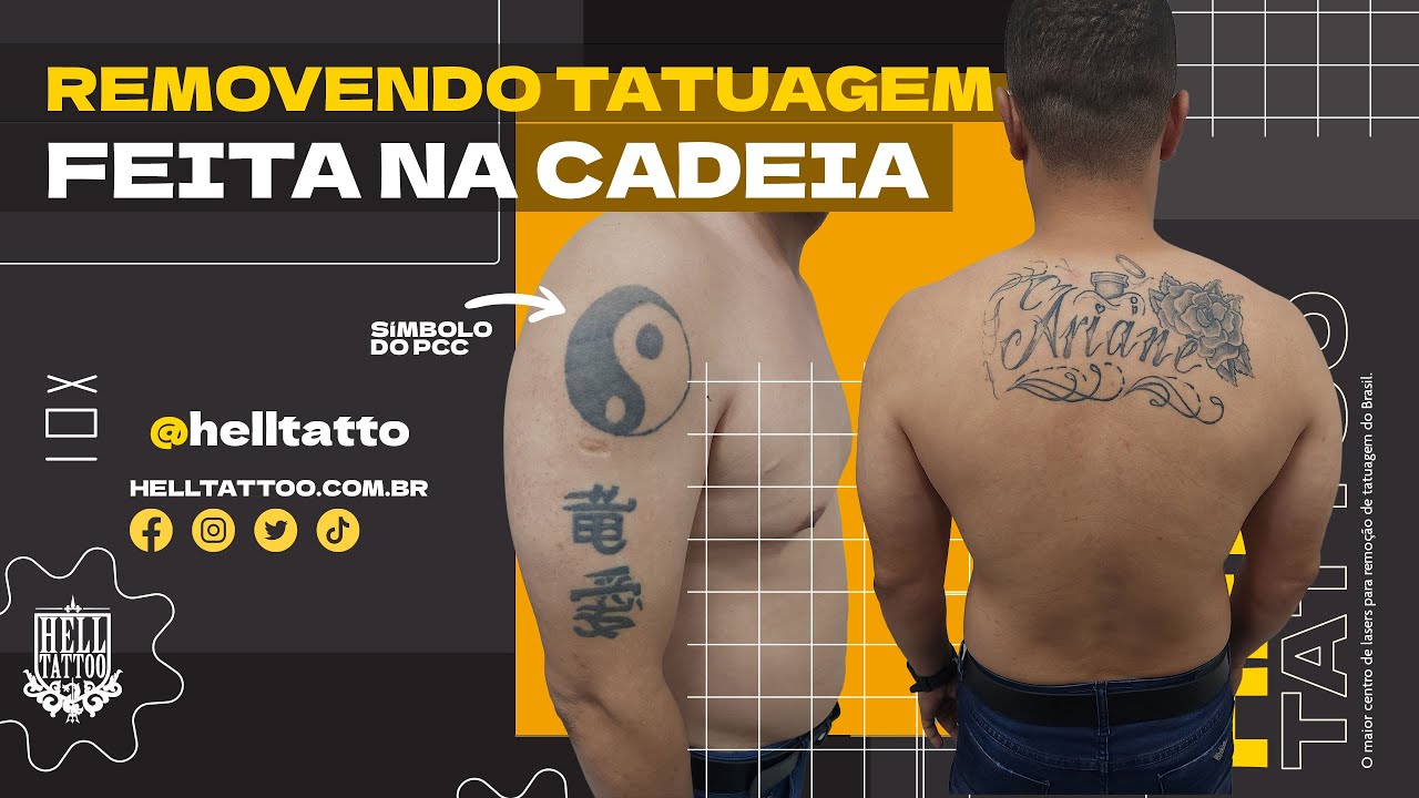 Removendo tatuagem de um ex integrante do PCC | Remoção de Tatuagem ...