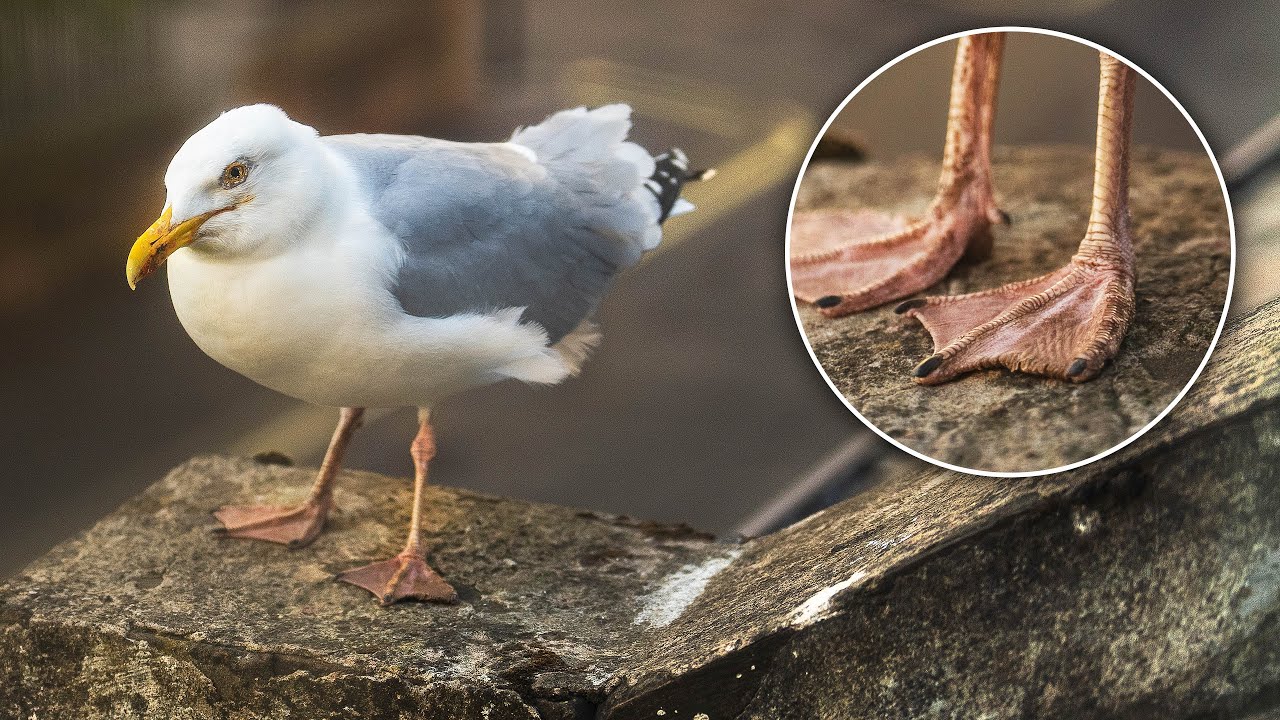 Update On Stevens Foot Injury! - YouTube