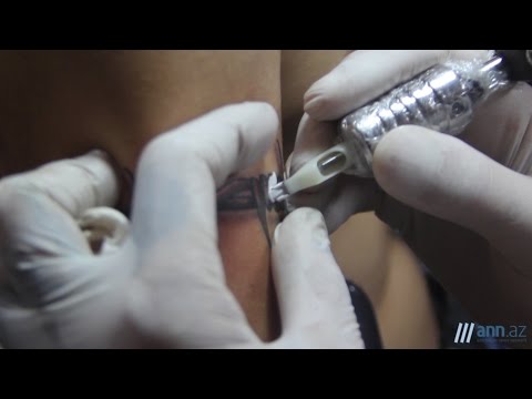 OBYEKTİVDƏ: Tatu: gözəl görünüş yoxsa xəstəlik mənbəyi?