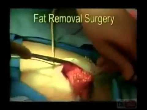 Linfa Alkali video 1