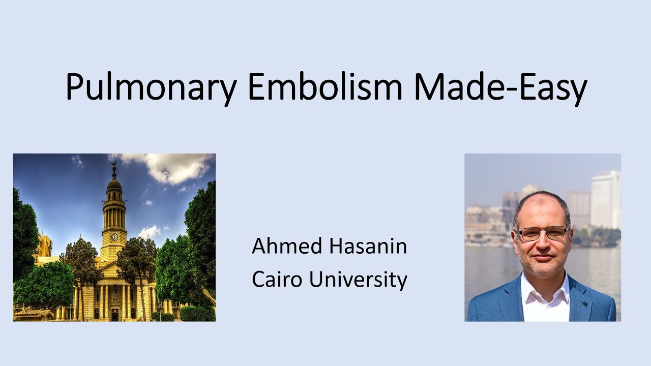 Pulmonary Embolism Made-Easy - YouTube
